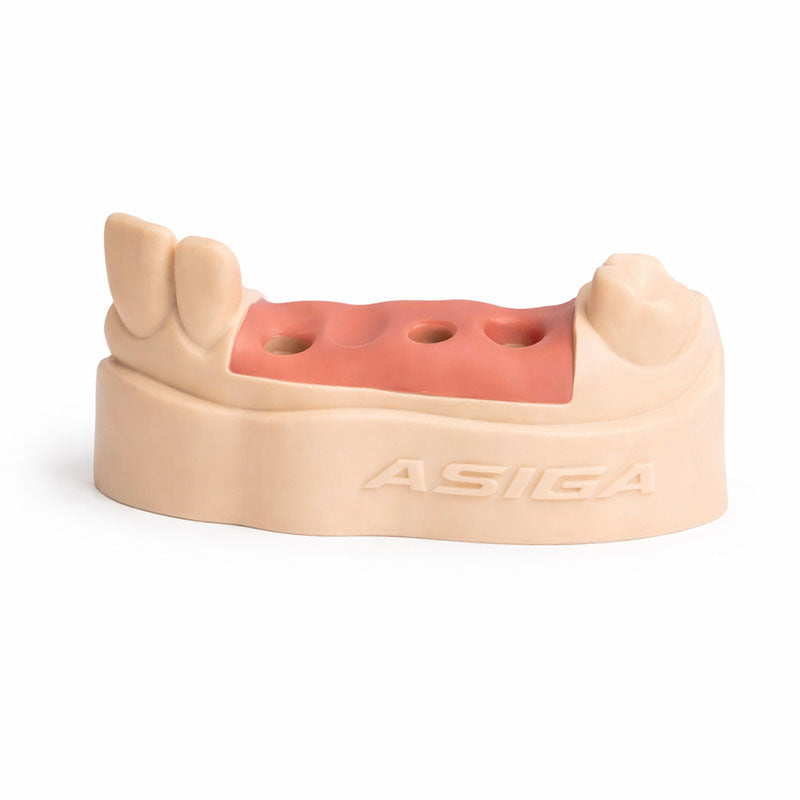 Asiga DentaGUM Flexible Gingiva 3D Resin Implant Models