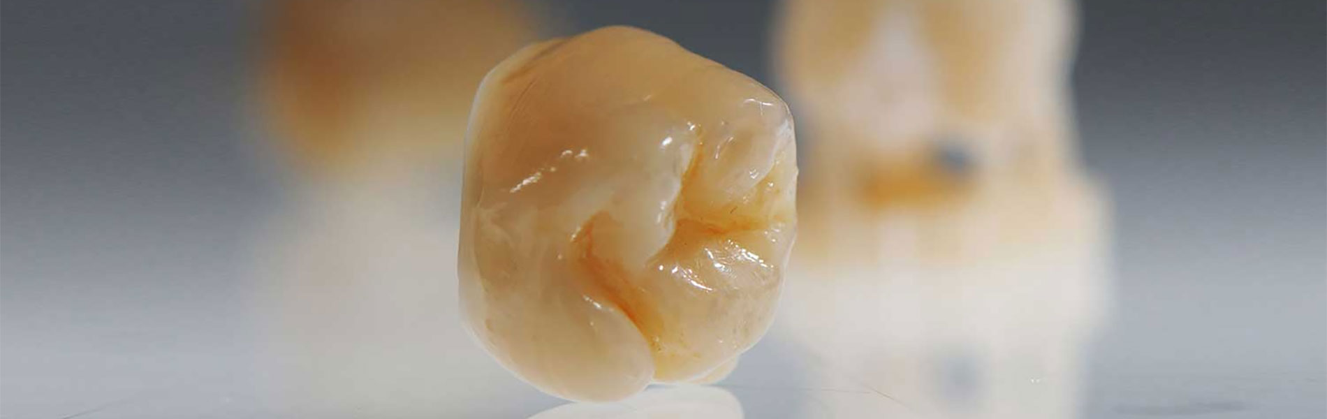 Resina 3D Varseo BEGO | Impresión dental DLP